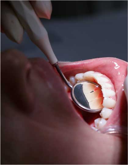 TEETH THAT STICK OUT - Face Teeth Smile