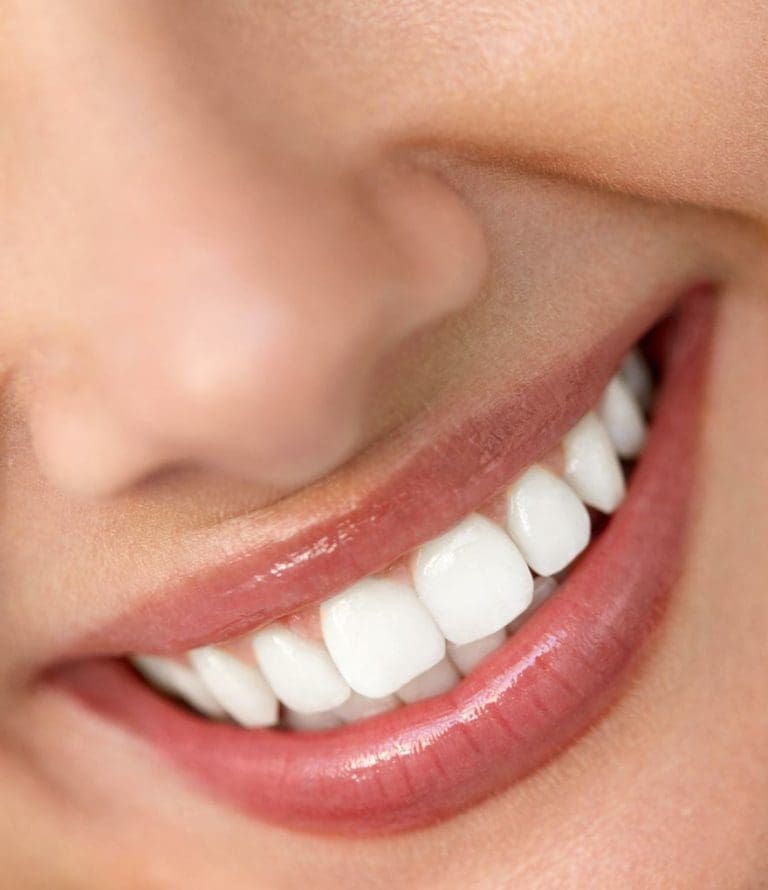 Composite Bonding Amersham - Face Teeth Smile